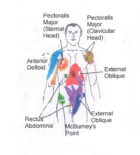 Posterior Trigger Points Neck