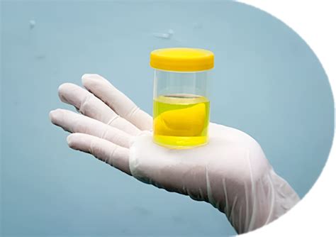 Urine Microbiome Testing • Screenme