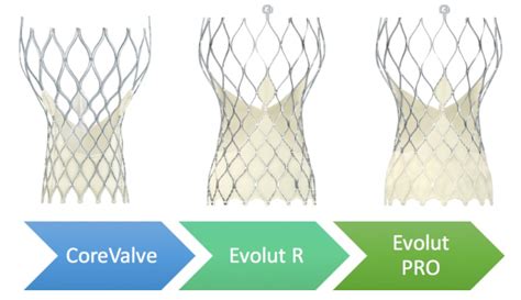Medtronic Innovative Solutions For Patients