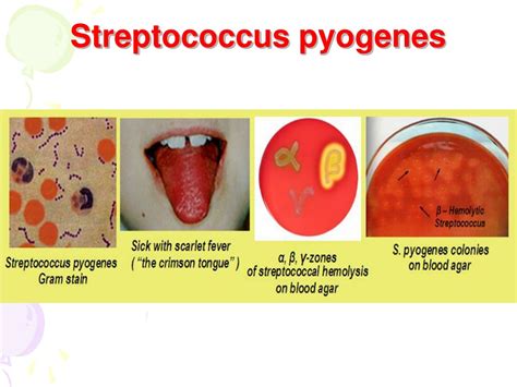 Ppt Pathogenic Cocci Staphylococci Streptococci Neisseria