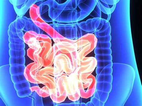 Computer Aided Colonoscopy Reliably Identifies Small Polyps