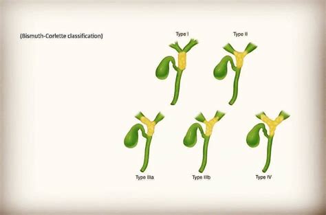 Cholangiocarcinoma Type