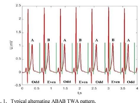 figure 1 from evaluation of machine learning techniques for ecg t wave alternans semantic scholar