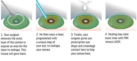 Lasik Eyecare Associates Of South Tulsa