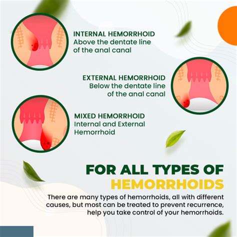Drpro™ Hemorrhoid Relief Cream Organically Formulated