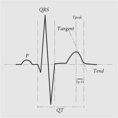The Schematic Presentation Of The Measurement Of The Tp Te Interval In Download Scientific