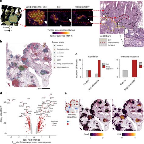 High Plasticity State And Heterogeneity Revealed By Lung Adenocarcinoma