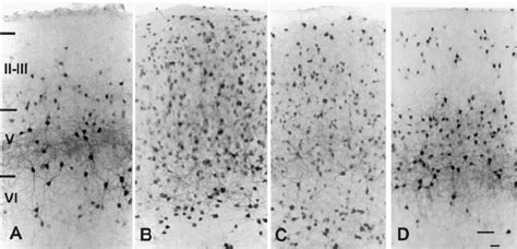 Histograms Of The Depth Distribution And The Dendritic Branching Download Scientific Diagram
