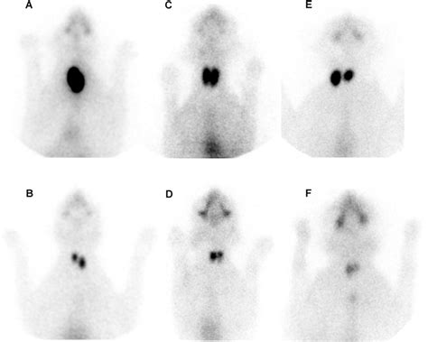 Thyroid Scintigraphy In 3 Cats With Goitrous Hypothyroidism Before And