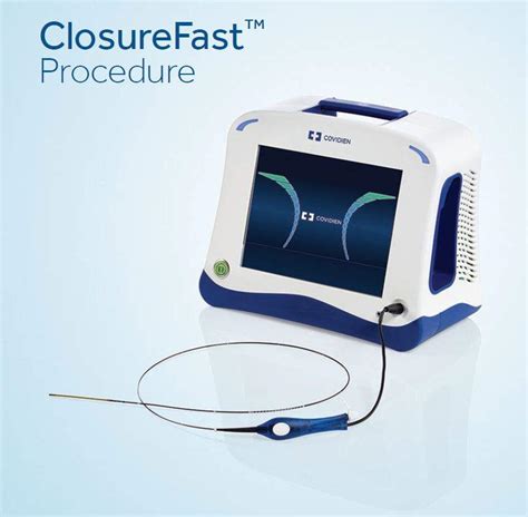 Closurefast™ Thermal Vein Closure Procedure