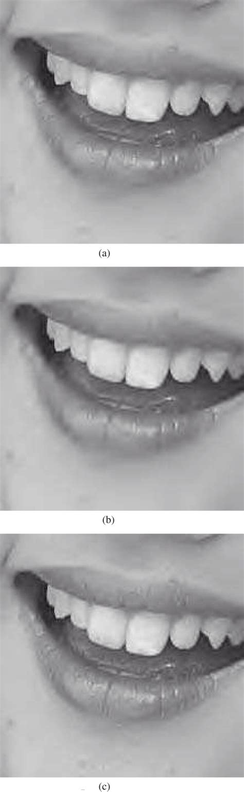 subjective comparison of the woman image encoded at 0 25 bpp a spiht