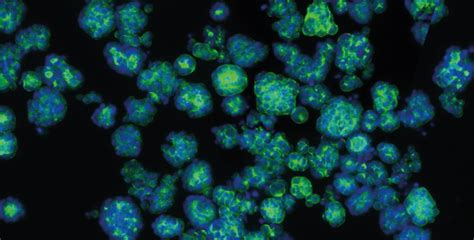 Cancer Research Metabolite Drives Tumor Development Swiss National Center Of Competence In