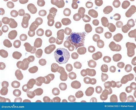 Pelgerhuët Anomaly Stock Image Image Of Cells Peanut 342661533