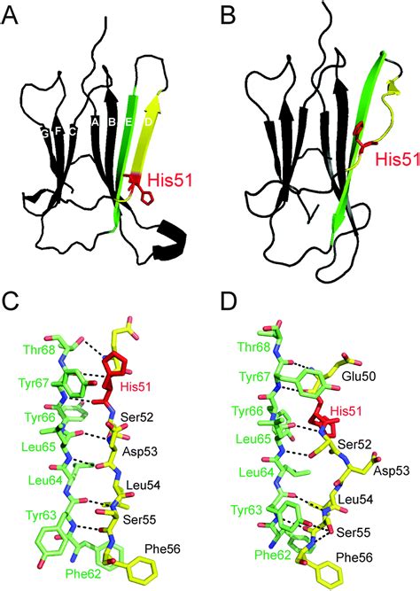 Insights Into The Role Of The Beta 2 Microglobulin D Strand In Amyloid