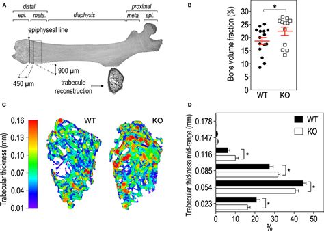 Frontiers Fmr Deficiency Impacts Body Composition Skeleton And Bone Microstructure In A