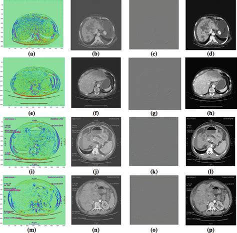 least square based prediction lossless compression outputs a p id1