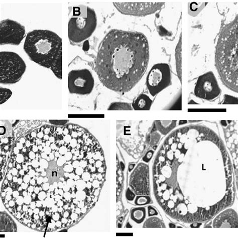 Histological Sections Showing Different Stages Of Gonadal Development