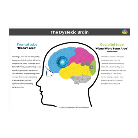 The Dyslexic Brain A3 Poster Learning Matters