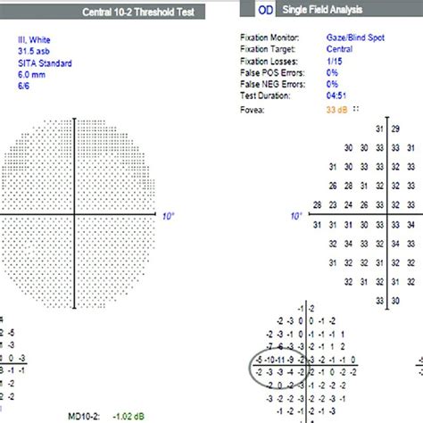 Humphrey Visual Field Testing Of Both Eyes A And B Right Eye Download Scientific