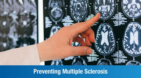 How Can You Prevent Multiple Sclerosis Plexus