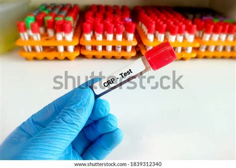 Inflammatory Marker Tests Photos And Images And Pictures Shutterstock