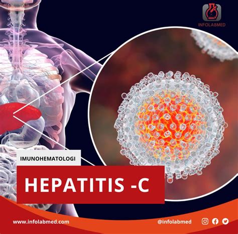 Pemeriksaan Hepatitis C