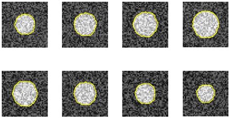 the contour detection results snr 14 db s 0 01 resize factor