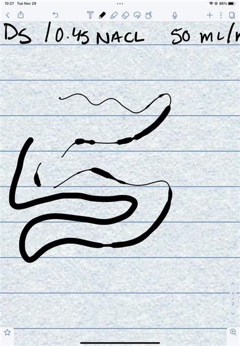 Pen Shortcut Bug Rkindlescribe