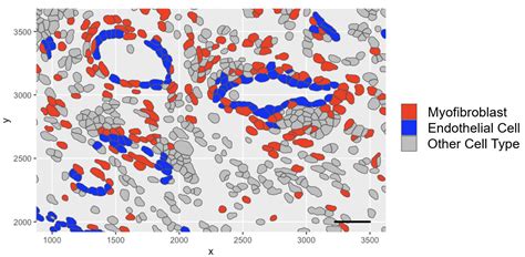 Spatial Transcriptomic Analysis Reveals Vascular Zonation Of Spatial Transcriptomic Analysis Reveals Vascular Zonation Of