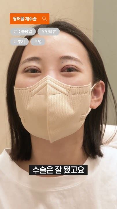성형외과 직원의 쌍꺼풀 재수술수술 5일차 리얼 후기 Shorts Youtube