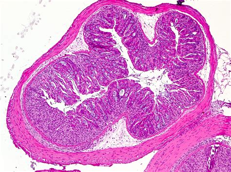Dss Induced Acute And Chronic Colitis Epistem