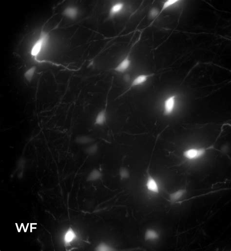 Structured Illumination Microscopy With Low Magnification Objectives