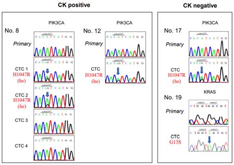 Sanger Sequencing Of Ck Positive Ctcs And Ck Negative Ctcs Sanger