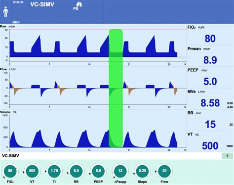 Ventilation Modes Neuroresus