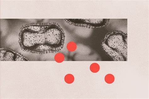 Can you die from monkeypox? – Deseret News