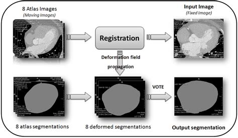 multi atlas based segmentation download scientific diagram