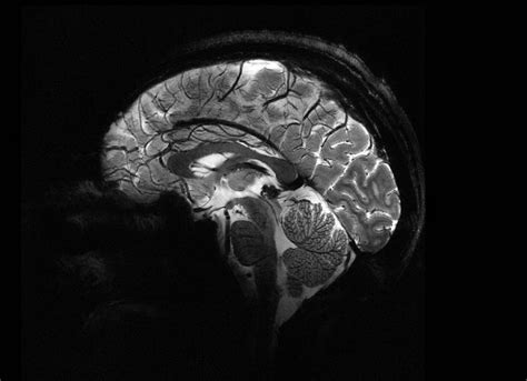 Worlds Most Powerful Mri Machine Captures First Stunning Brain Scans