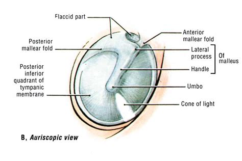 Temporal Bone Tympanic Membrane Ranzcrpart1 Wiki Fandom Powered By