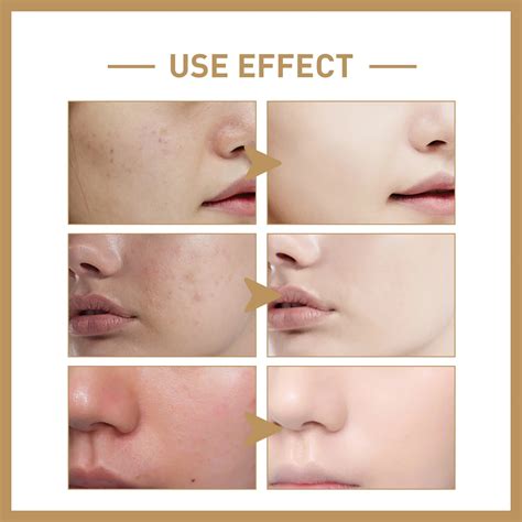 Korean Product Rice Toner,Deep Hydrating,Moisturizing And Firming Toner ...