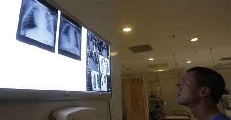 Fhi 360 On Linkedin Revolutionizing Tuberculosis Detection In Vietnam Think Global Health