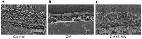 Scanning Electron Microscopy To Assess Cochlear Surface Structure A