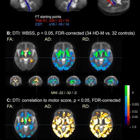 Diffusion Tensor Imaging A Whole Brain Based Spatial Statistics Wbss Download Scientific