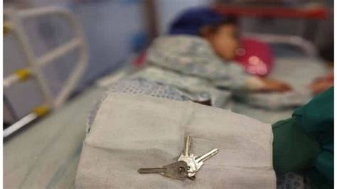 خارج کردن دسته‌کلید از معده کودک ۶ ساله سبزواری عکس خبرآنلاین
