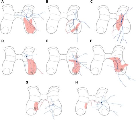 Reconstructions Of Inhibitory Multifunctional Interneurons A F Download Scientific Diagram
