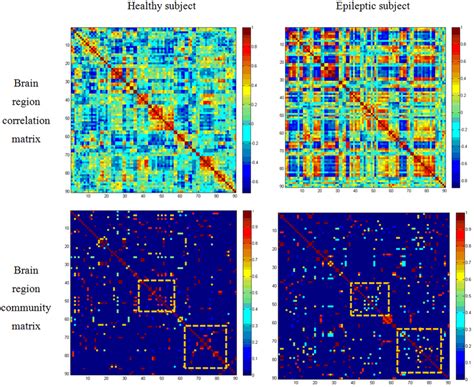 brain region functional network visualization of the correlation