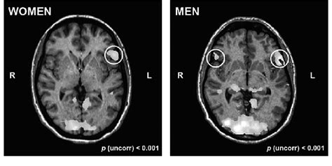 A Simple Question A Hard Answer Is This A Sex Difference Or A Download Scientific Diagram