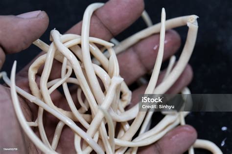 Ascariasis Adalah Penyakit Yang Disebabkan Oleh Cacing Gelang Parasit Ascaris Lumbricoides Untuk