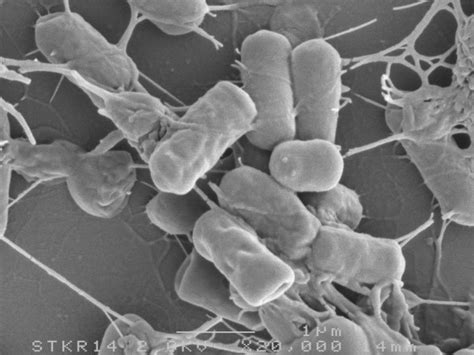 Scanning Electron Microscopic Image Of B Subtilis 168 Download