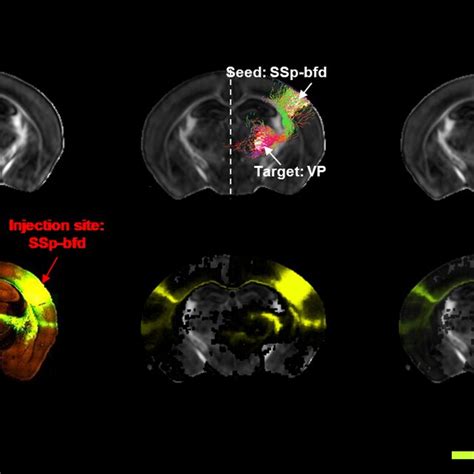 Transferring Tracer Map To Each Subjects Native Dmri Space For Download Scientific Diagram