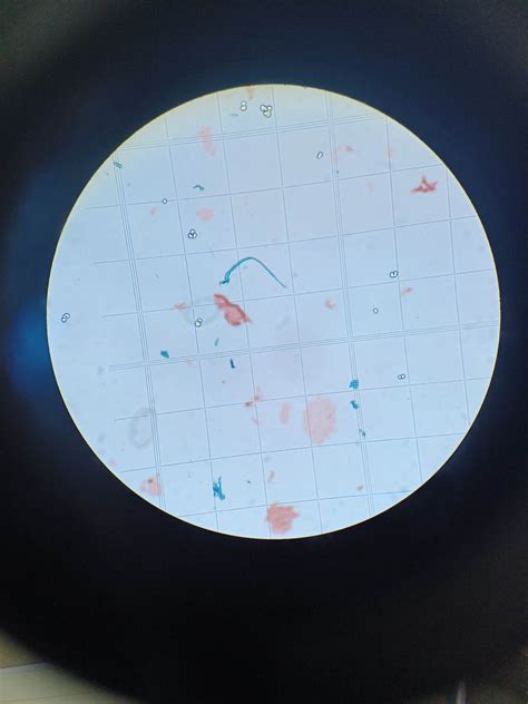 What Are Those Red Spots In The Image When Staining Cells With Trypan Blue Researchgate